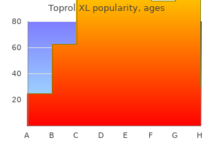 Buy cheap Toprol XL no RX. Effective online Toprol XL no RX.