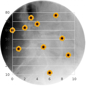 Buy online Plaquenil cheap. Trusted Plaquenil online OTC.