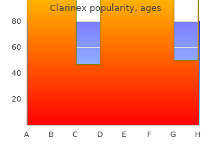 Purchase Clarinex no RX. Safe Clarinex OTC.
